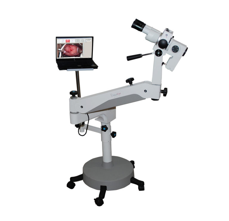 AL-106 HD Video Colposcope - MedGyn
