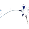 HSG Procedure Kit With Shapeable HSG Catheter - MedGyn